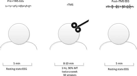 Schematic Presentation Of RTMS Modified From About Min EEG Data Download Scientific