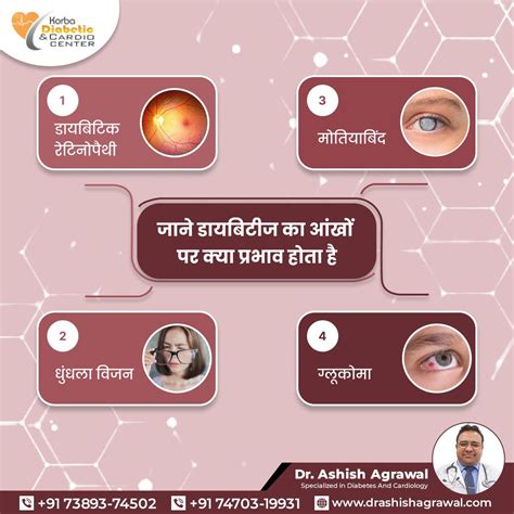 Dr Ashish Agrawal On Linkedin Diabetes Retina Cataracts Blurvision Blur Glucoma
