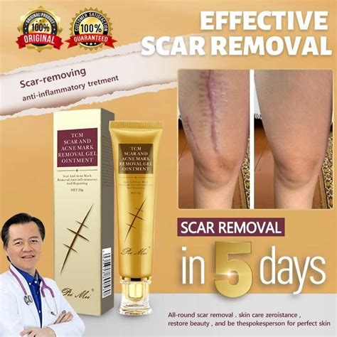 Fix Scar Removal Original Scars Remover For Old Scars Pimples Remover