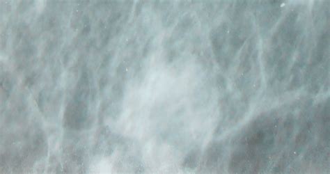 Шкала Bi Rads в маммографии и УЗИ молочных желез