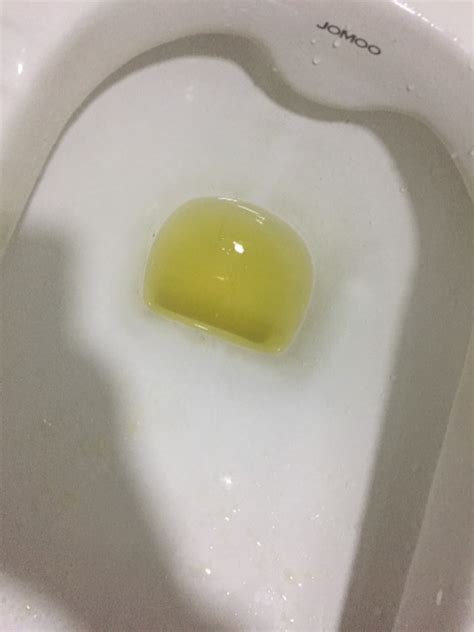 尿液有油状漂浮物图片 脂肪尿的图片 伤感说说吧