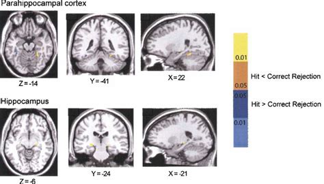 Brain Regions Showing Hit Vs Cr In The Associative Recognition Task Download Scientific