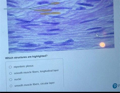 [answered] Which Structures Are Highlighted O Myenteric Plexus O Smooth Kunduz