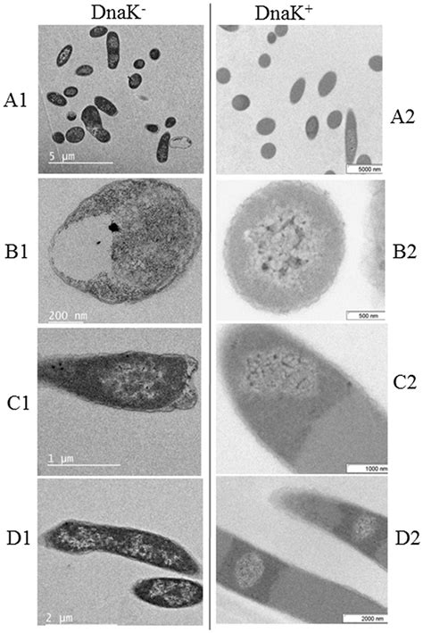 Comparative Analysis Of The Effects Of Citrate Aunps On E Coli Dnak