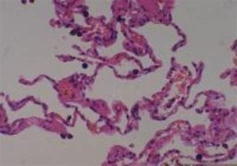 Novus Biologicals™ Human Multi Organ Tissue Microarray Normal Human