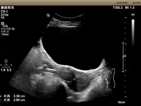Uf Segmentation Instance Segmentation Dataset And Pre Trained Model By Makerere University