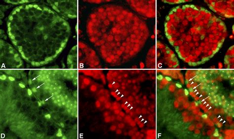 Cux1 Is Not Expressed In Spermatogonia Paraffin Sections Of Testes Download Scientific Diagram