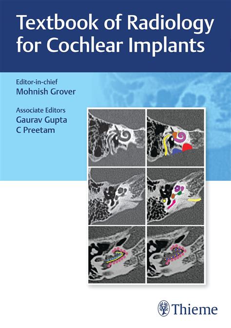 Textbook Of Radiology For Cochlear Implants 9789392819261 Thieme Webshop
