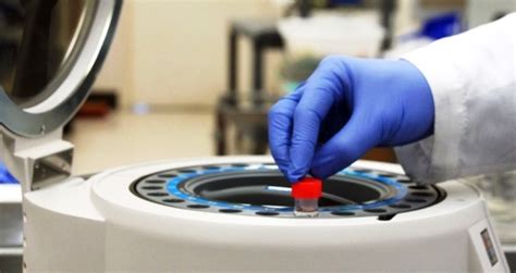 Reducing Recall Risk With Rapid Microbial Testing Asia Pacific Food Industry