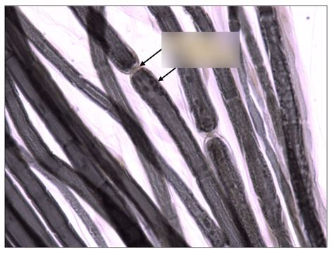 Schwann Cells Diagram Quizlet
