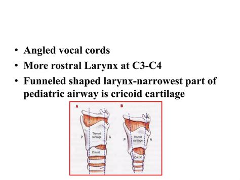 Airway Assessment In Paediatrics Patients Laryngoscopy Intubation Pptx Ear Nose And Throat