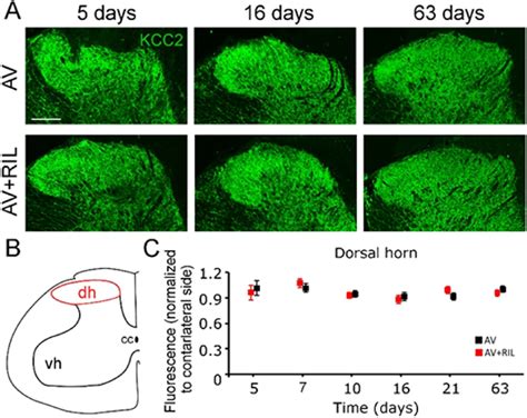 Analysis Of Kcc2 Expression In The Dorsal Horn Of The L4 5 Spinal Download Scientific Diagram