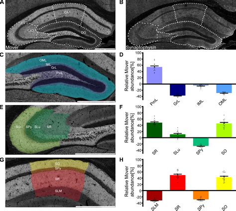 Quantifying The Heterogeneous Distribution Of A Synaptic Protein In The Mouse Brain Using