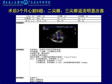 房颤合并心衰患者导管消融策略及评价 严道医声网