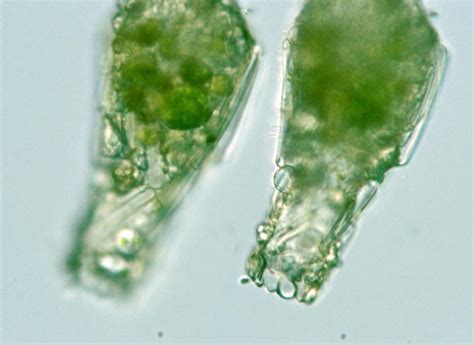 Protist Images Difflugia Oblonga