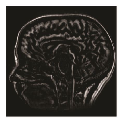 the registration results for brain images using the cpu based and