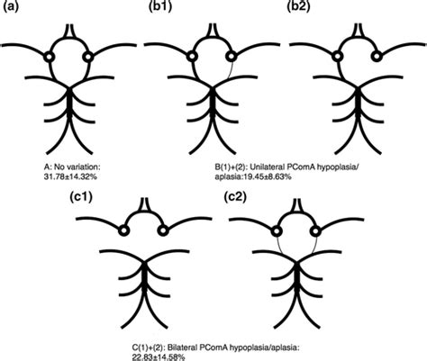 Anatomical Variations Of The Circle Of Willis And Their Prevalence