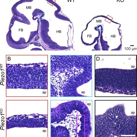 fluorescent ish of piezo1 mrna in the e10 5 mouse hindbrain
