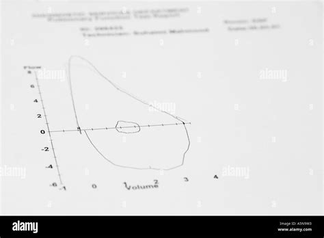 Pulmonary Function Test Graph At Estela Sharp Blog