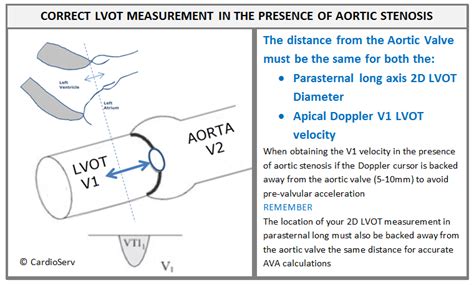 Aortic Root Measurement