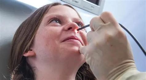 What Is A Nasal Endoscopy Features Of The Procedure Medicine