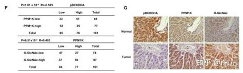 If9995 Cell Reports 代谢重编程：破坏谷氨酰胺成瘾，支链氨基酸分解代谢维持肝癌进展 知乎