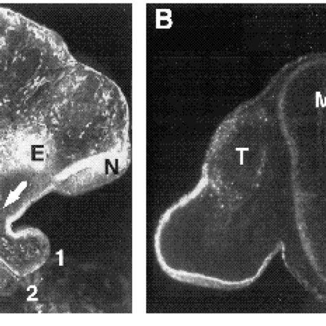 Pdf Vital Dye Of Cranial Neural Crest Migration In The Mouse Embryo