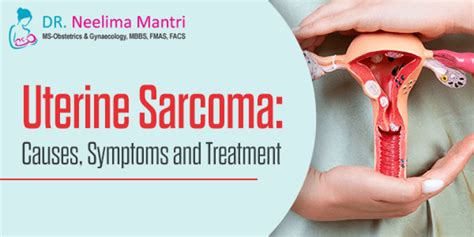 Uterine Sarcoma Causes Symptoms And Treatment Best Female