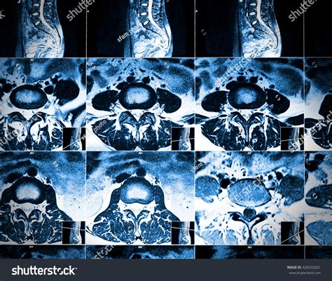Ct Scan Internal Organs Stock Photo 426532501 Shutterstock