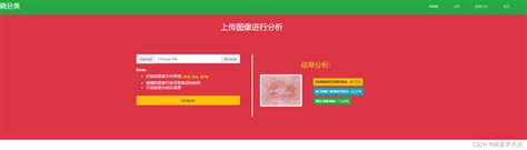 基于ISIC数据集的皮肤病黑色素瘤分类研究与实现 编程之家