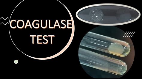 Coagulase Test Biochemical Test For Staphylococcus Aureus Youtube