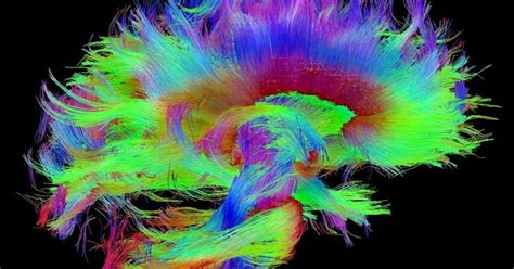 The Human Connectome Project Is Turning Brain Scans Into The New
