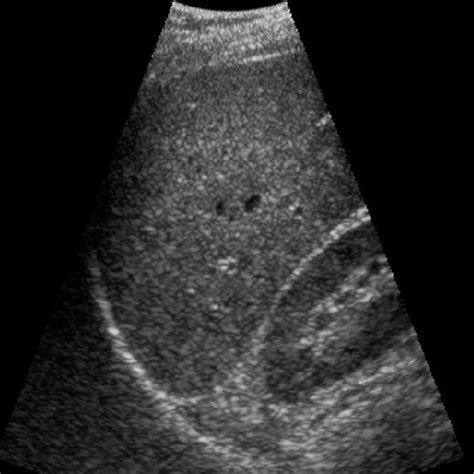 Pdf Sound Speed Correction In Ultrasound Imaging