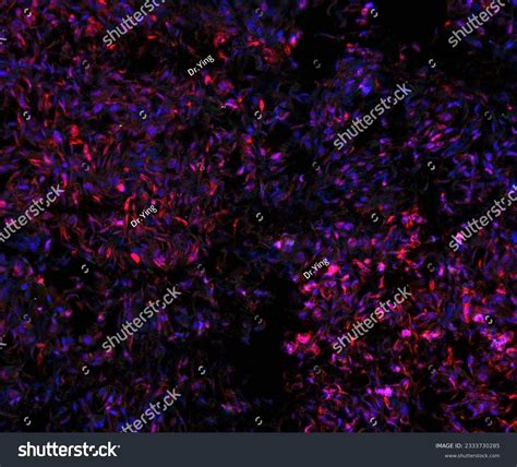 9 Immunofluorescence Technique 图片、库存照片、3d 物体和矢量图 Shutterstock