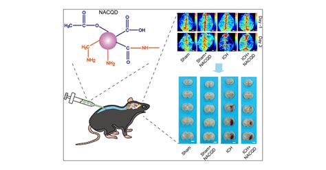 Multifunctional Carbon Quantum Dots Iron Clearance And Antioxidation