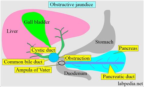 Bilirubin In Urine
