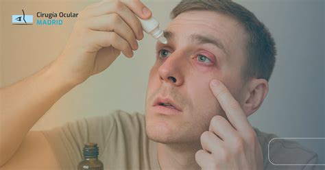 Conjuntivitis Vírica Tratamiento Y Prevención