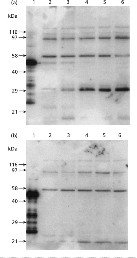 Table 1 From Analysis Of Spore Cortex Lytic Enzymes And Related Proteins In Bacillus Subtilis
