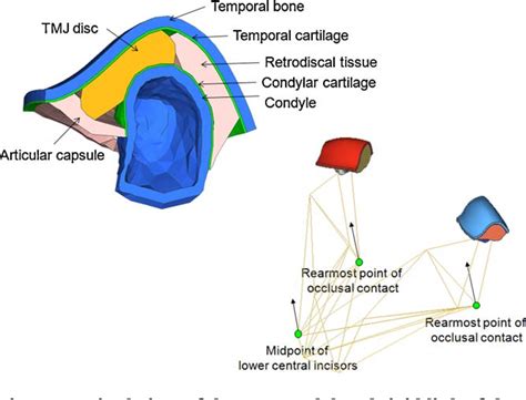 Figure 1 From Three Dimensional Finite Element Analysis Of Cartilaginous Tissues In Human