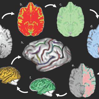 An Outline Of The Image Processing Pipeline As Implemented In Download Scientific Diagram