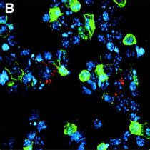 Reovirus T1l In Association With Double Negative Dcs Download