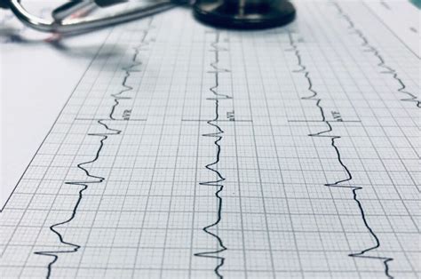 Afib Prevention Meaning Symptoms Diagnosis Treatment And More All You Need To Know About