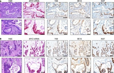 Image Cropping On White Boundaries From A Complex Image Using Python Stack Overflow