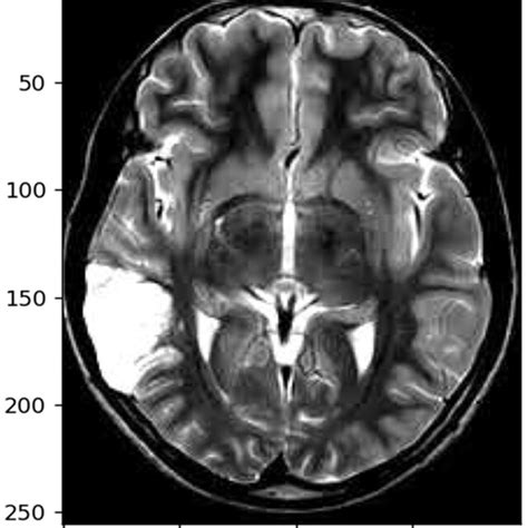 Threshold Segmentation Download Scientific Diagram