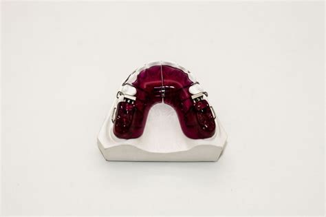 Twin Block Kfo Labor Mannheim Julius Gehl Julius Gehl In Mannheim Kieferorthopädie