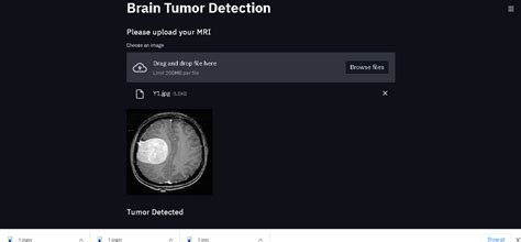 GitHub LaxmanSingh Brain Tumor Detection