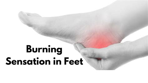 Causes Of Burning Sensation In The Feet That You Should Off