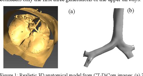 Figure 1 From Ultrafine Particle Transport And Deposition In The Upper Airways Of A Ct Based