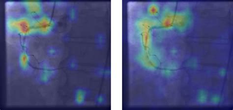 Signature Activation A Sparse Signal View For Holistic Saliency Paper And Code