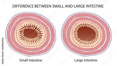 Difference Between Small And Large Intestine Stock Illustration Adobe